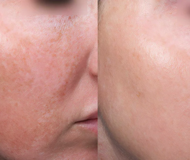 Home | Synerchi Medical Spa